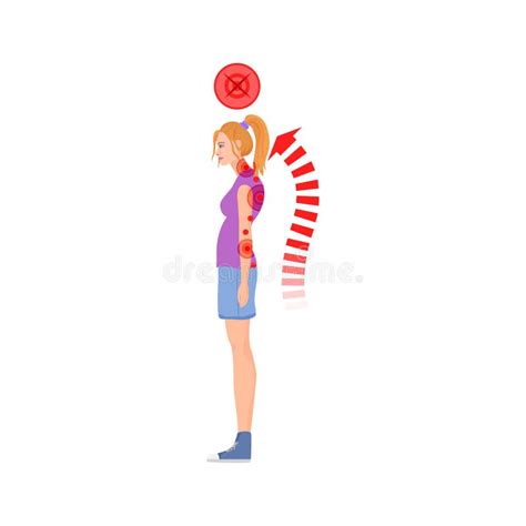 Standing Woman With Incorrect Spine Posture Stock Vector Illustration Of Position Correct