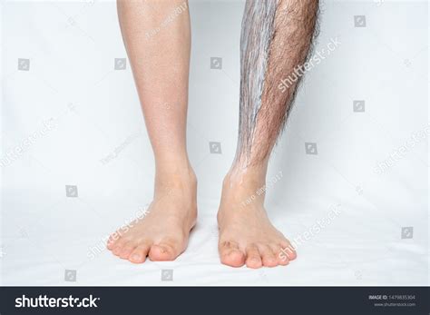Legs Hair Removal Men Before After Stock Photo Edit Now