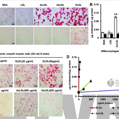 Enzyme Modified Low Density Lipoprotein Eldl Endocytosis By Aortic