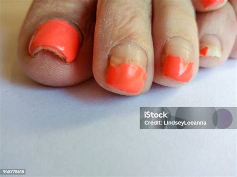 심하게 못생긴 여자의 발 긴 연어 색된 발톱을 신랑 페디큐어가 필요 합니다 연체 페디큐어입니다 흰색 배경에 고립 건강관리와 의술에 대한 스톡 사진 및 기타 이미지 Istock