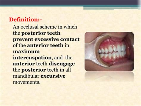 Occlusion In Dentistry Pptx