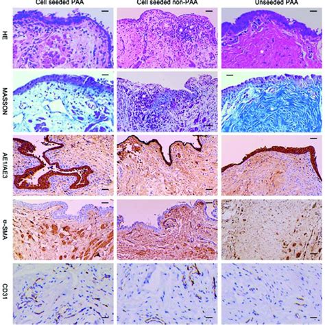Histological And Immunohistochemical Assessment Of Urethral