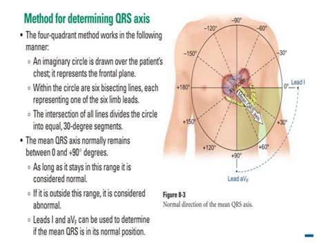 ECG STEPS 10 STEPS IN ECG INTERPRETATION PPTX Heart And Cardiovascular Diseases Diseases