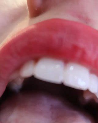 Colleen Ballinger Nude Porn Pictures Xxx Photos Sex Images Pictoa