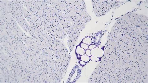 Cardiac Muscle In Section Filmed On Bright Field Background Under