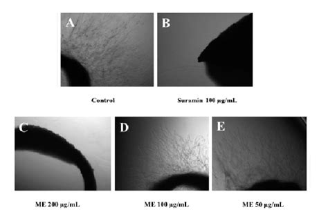 Rat Aortic Ring Assay The Effect Of Different Concentrations 50 200