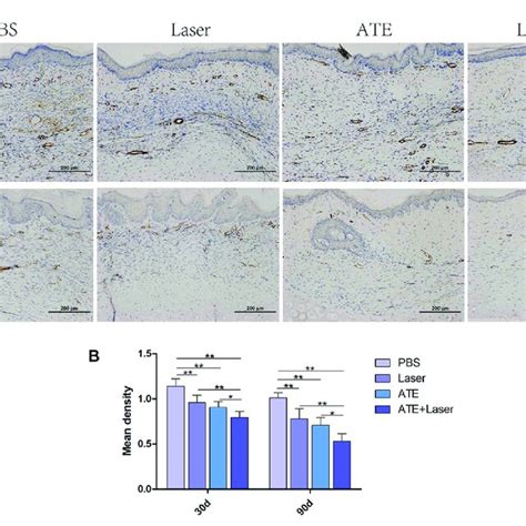 Immunohistochemical Staining Of α Sma A The Results Showed That The
