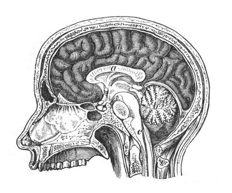 Brain Scan Mental Illness Illustrations Royalty Free Vector Graphics