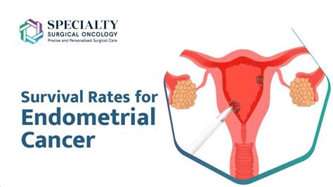 Endometrial Cancer New Findings On Endometrial Cancer Treated With