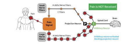 Pain Gate Theory Explained Design Talk