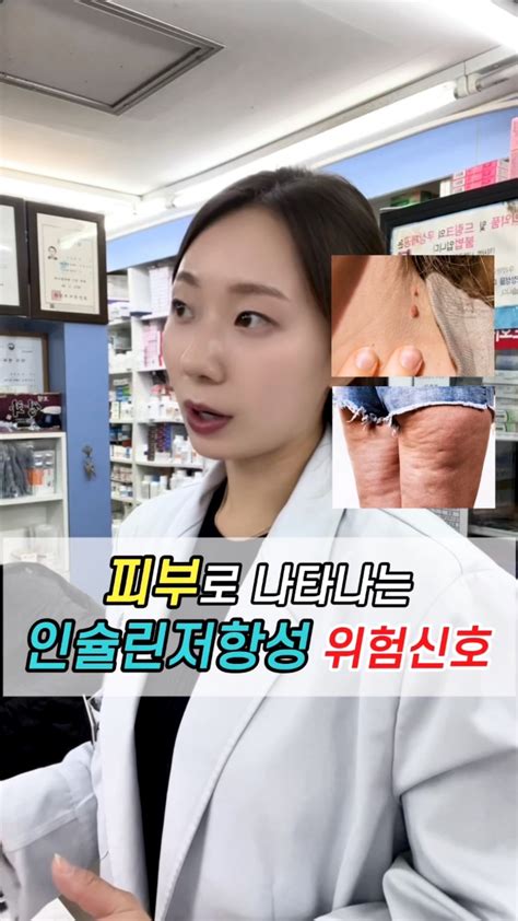 샤인 약사ㅣ김혜란 🌿디톡스 필요한 사람들 꼭 체크해야하는 영상🙌🏻 ☠️ 몸에 독소가 가득하면 생기는 증상 ☠️ ☑️ 유난히 지독한 방귀냄새 → 계란 썩은냄새 아시나요