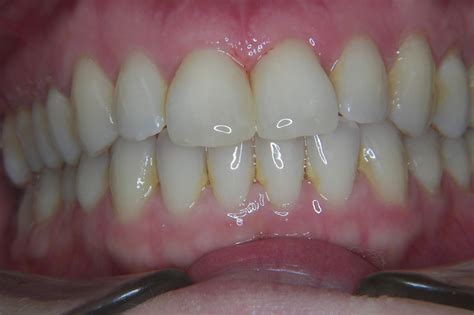 Odontología conservadora Clínica dental Ráez