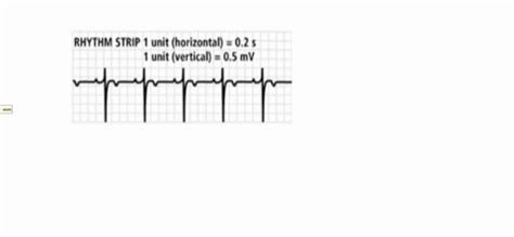 SOLVED Heart Rate The Following Graph Shows A Persons Heart Rate While Doing Exercise Write A