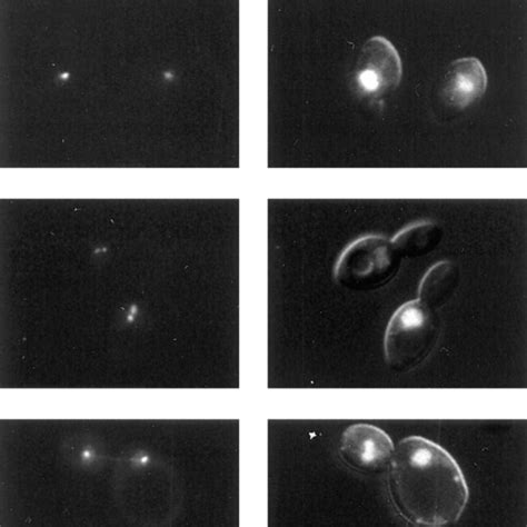 Localization Of Stu2p Gfp Fusion Protein Gfp Fluorescence Was Download Scientific Diagram