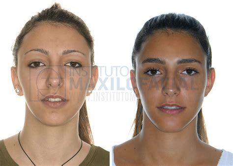 Gemma Instituto Maxilofacial