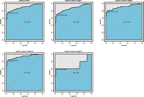Diagnostic Value Of GPSM2 MRNA In Patients With Liver Cancer And