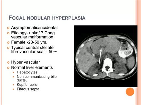 Liver Lesions Symposium Radiology Pptx