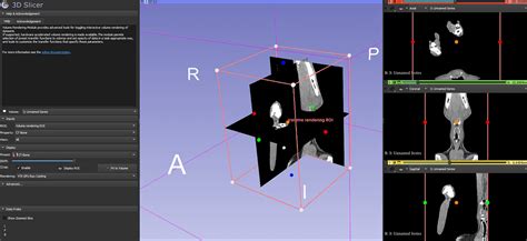 Only Flat Slices Show In 3d View Support 3d Slicer Community