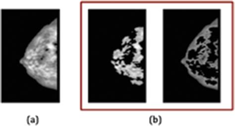 A Input Image And B Otsu Processing Download Scientific Diagram