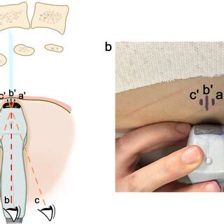 Marking Error Due To Parallax Error Parallax Error In Marking The Download Scientific Diagram