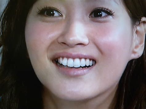 藤本美貴さんの前歯の画像 僕の審美歯科ガイド｜前歯の差し歯治療で後悔しないための情報源