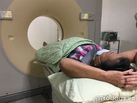 不抽菸家庭主婦也罹肺癌 醫師提醒高風險族群主動篩檢 Ettoday健康雲 Ettoday新聞雲