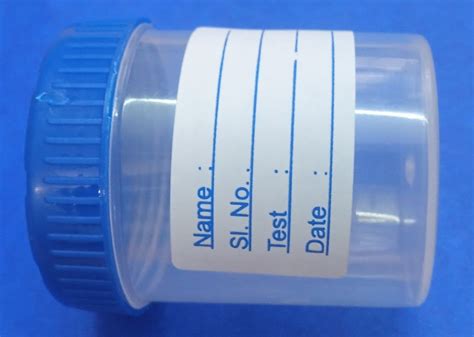 50ml Specimen Container For Chemical Laboratory At ₹ 10 Piece In Bengaluru