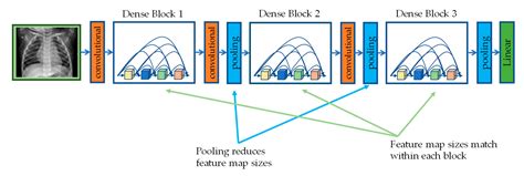 Transfer Learning With Deep Convolutional Neural Network Cnn For Pneumonia Detection Using