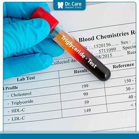 Triglyceride Là Gì Chỉ Số Triglyceride Cao Có Nguy Hiểm Không Dr Care