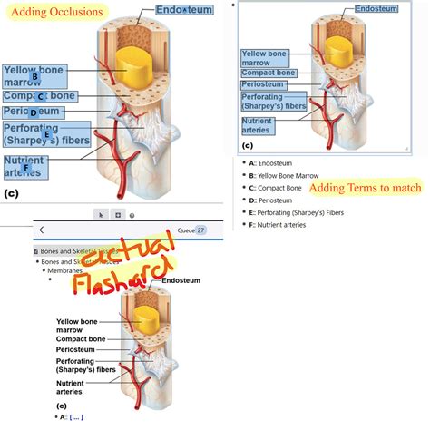 Occlusion Flashcards Remnote