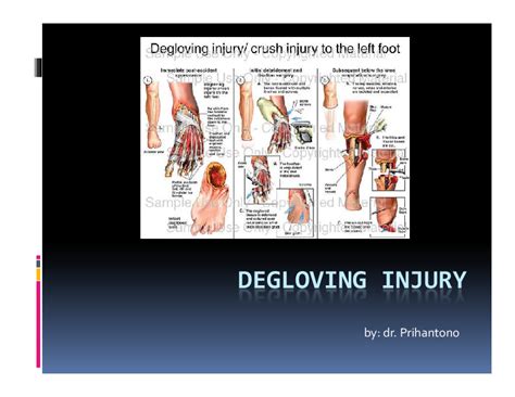 Degloving Injury Pri Pdfcoffeecom