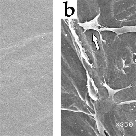 A Sem Analysis Showing Bacterial Cellulose Bc Membrane Without