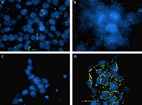 Examples Of Cytological Specimens At Todd Kinder Blog