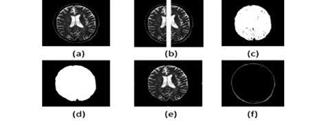 Preprocessing Steps A Original Scan B Dividing Image C Stripping Download Scientific
