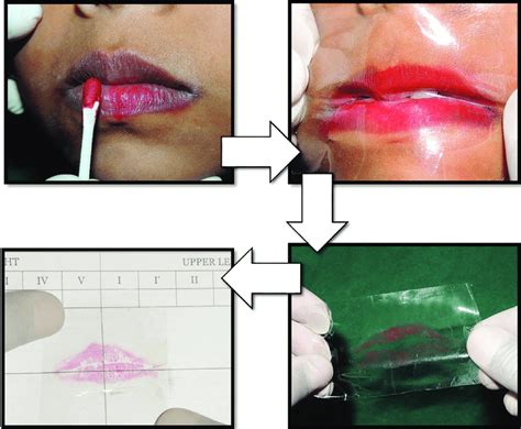 Method For Obtaining Lip Print Download Scientific Diagram