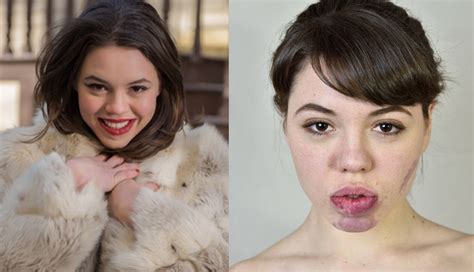 This Model Spent Years Trying To Remove Her Birthmark—now Shes