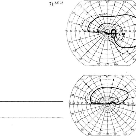 Visual Field Defects In Aion With Goldmann Perimeter A Showing Download Scientific Diagram
