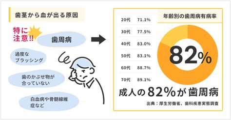 歯茎から血が出る？歯ぐきの出血原因・症状と歯周病のセルフチェック｜虎ノ門ヒルズ 歯科•医科 龍クリニック