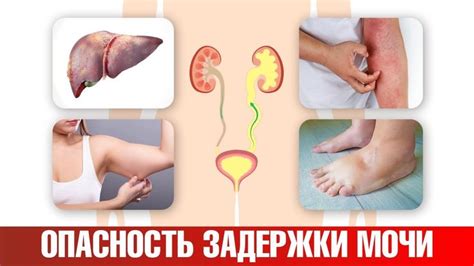 Задержка мочи опасна для здоровья 📢 Решить проблему можно