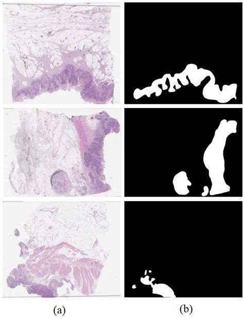 Samples Of The CRC Data Set A CRC Images B Corresponding Masks Download Scientific Diagram