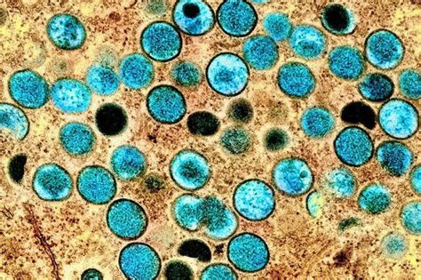 Doh Sex Not Only Form Of Contact That Puts People At Risk For Mpox