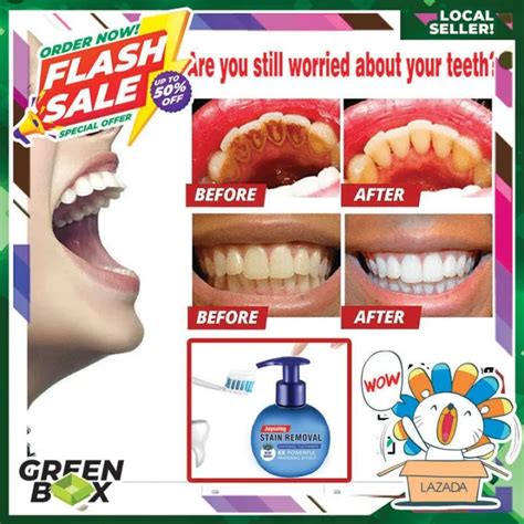 Jaysuing Stain Removal Teeth Whitening Toothpaste Lazada Ph