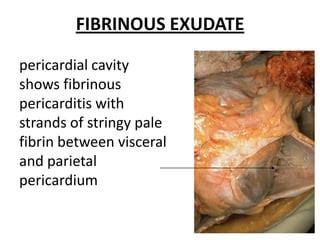 4 Outcomes And Morphology Dr Ashutosh Kumar Pdf