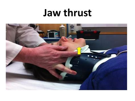 Basic Airway Management Pdf