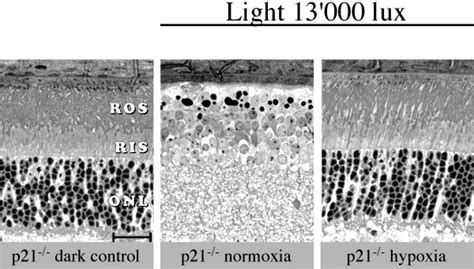 Role Of P21 In Hypoxic Preconditioning Hypoxic Preconditioned