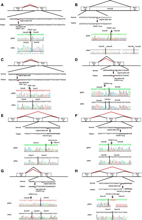 Figure 1 From Detection Of Splicing Abnormalities And Genotype
