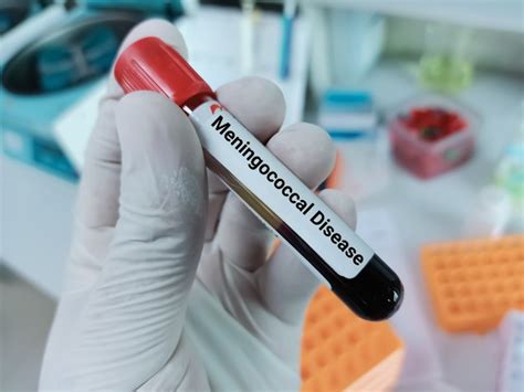 Nsw Meningococcal Alert After Person Dies From Disease Healthtimes