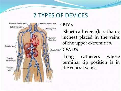 Central Venous Access Catheter Artofit