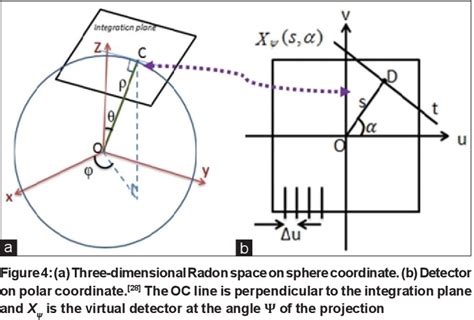 Figure 4 From Low Dose Cone Beam Computed Tomography Reconstruction Through A Fast Three