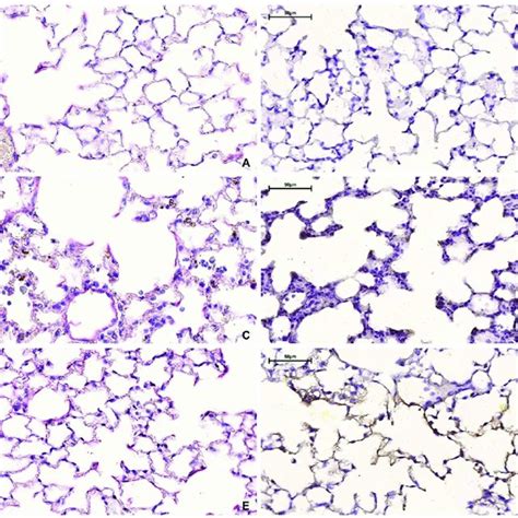 Representative Photomicrographs Of Lung Tissue H And E Staining A And